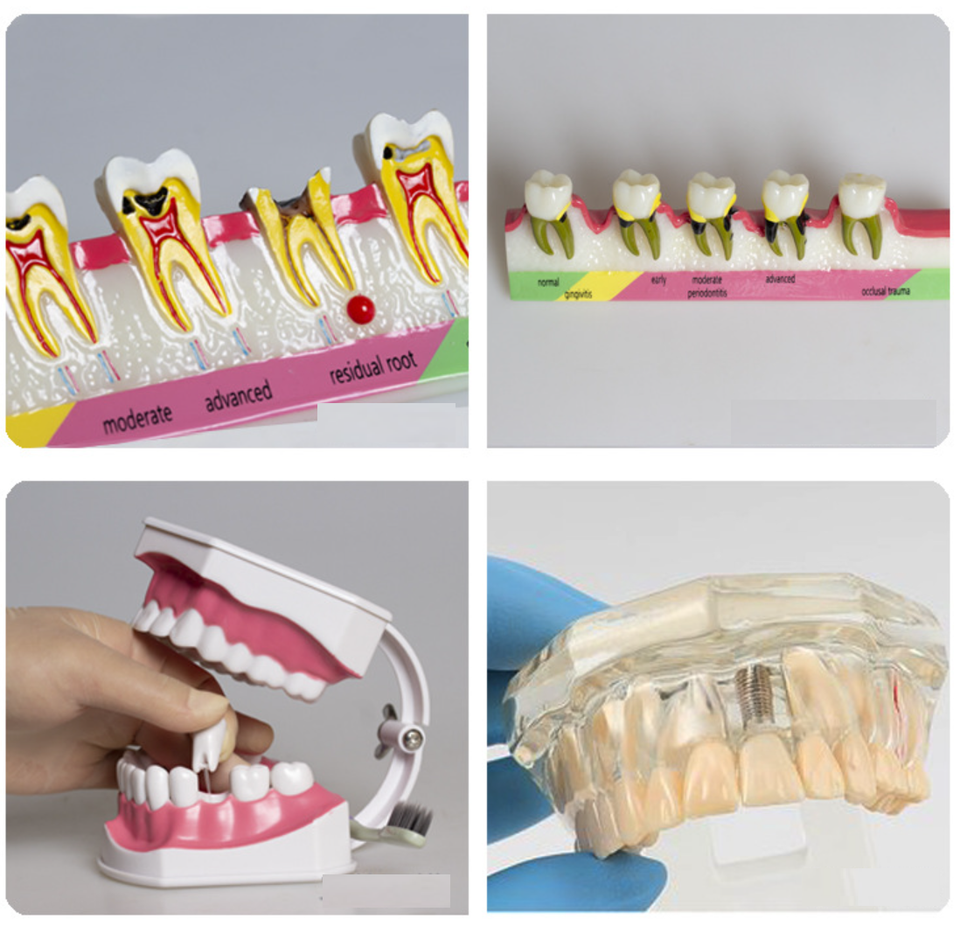 Dental Typodont Teeth Study Teach Tooth Model Implant Endo Caries ...