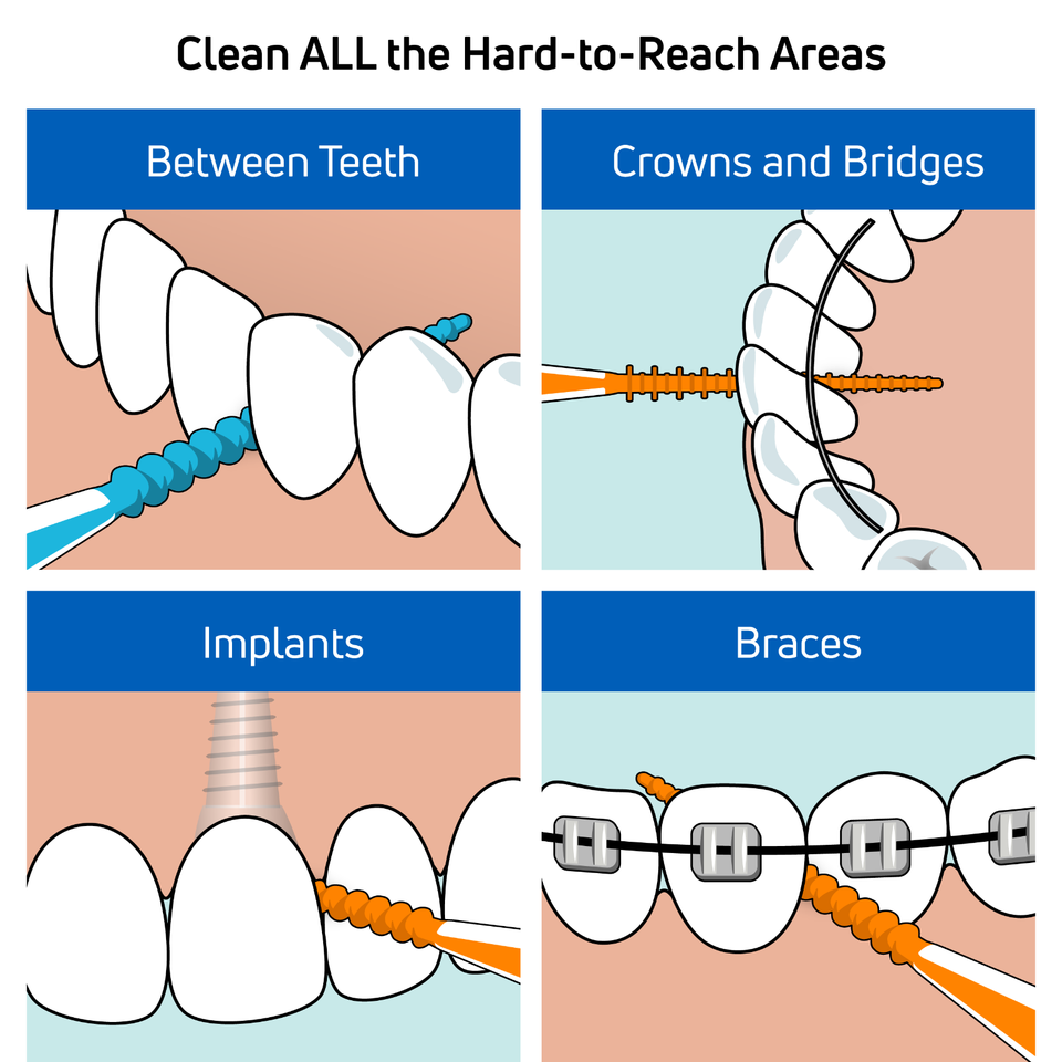 TEPE EasyPick™ Blue - M/L 36-pack - Dental Floss Picks | eBay