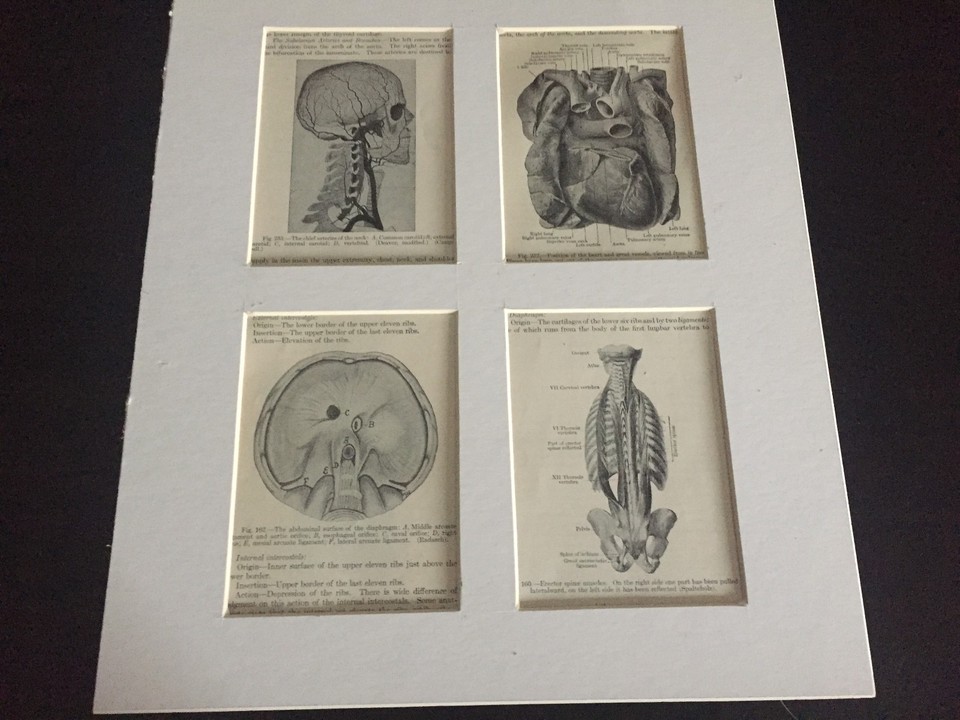 VINTAGE RARE MATTED ODDITY READY TO FRAME: Four Medical Plate Matted ...