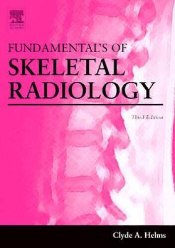 Fundamentals of Skeletal Radiology - Paperback By Clyde A. Helms - GOOD ...