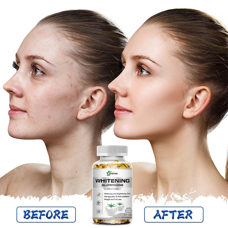 ZHPHK White Tomato Glutathione Capsules Whitening Skin Anti-glycation ...