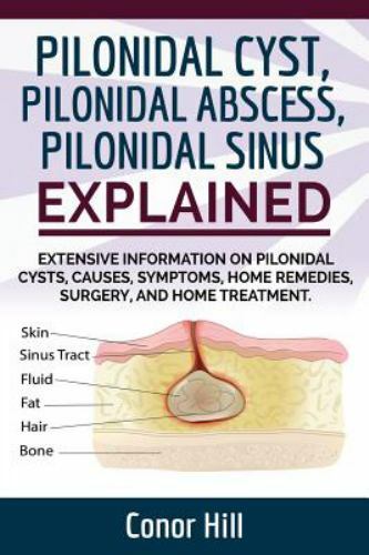 Pilonidal Cyst Fast Healing Guide. Fast Track Guide to Pilonidal Cyst Relief by Understanding ...