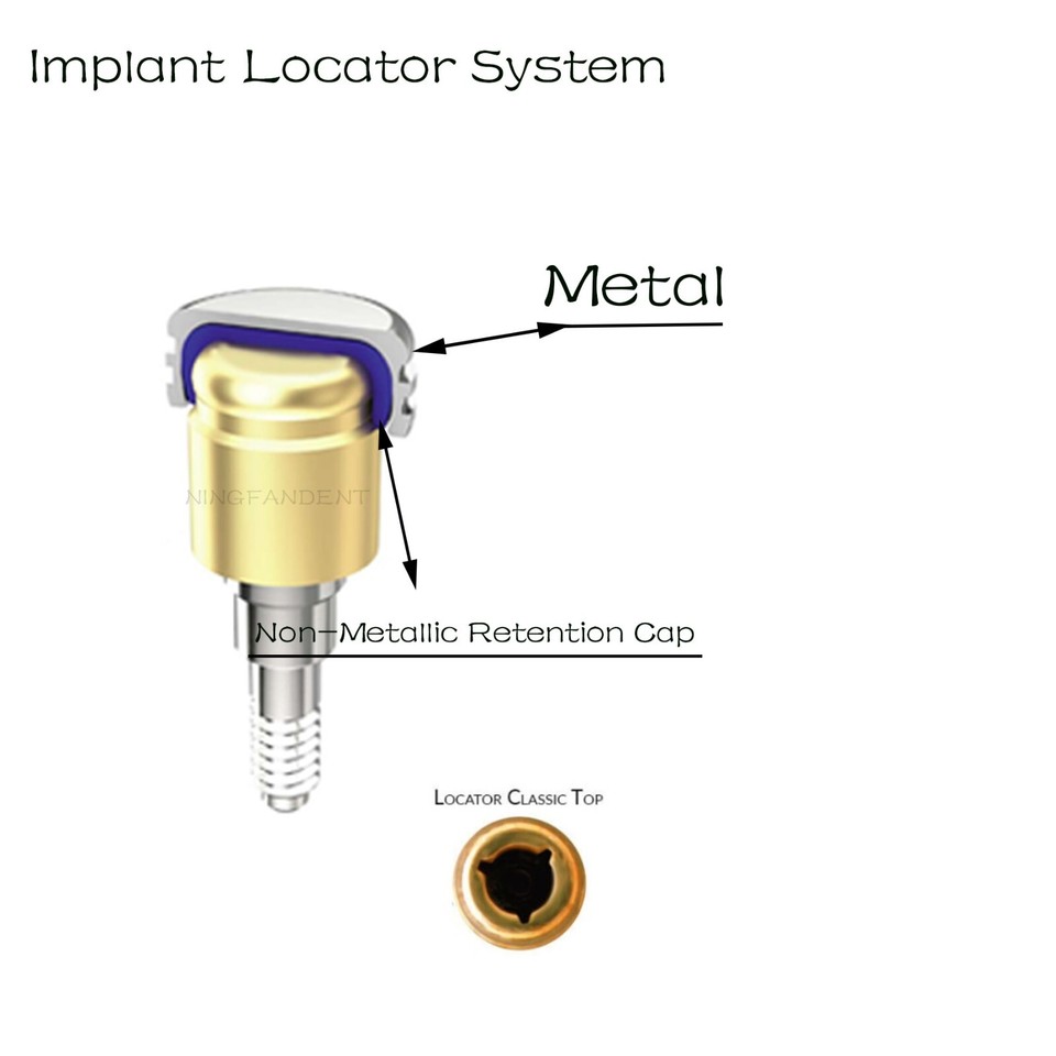 20Pcs US Dental Locator Replacement Metal Housing & Lab Cap Assembly | eBay