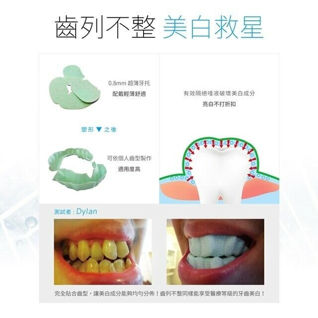 Protis Whiter-T 3D Formula Teeth Whitening Kit (5-7 days) 普麗斯 3D藍鑽牙托式深層長效牙齒美白組 | eBay