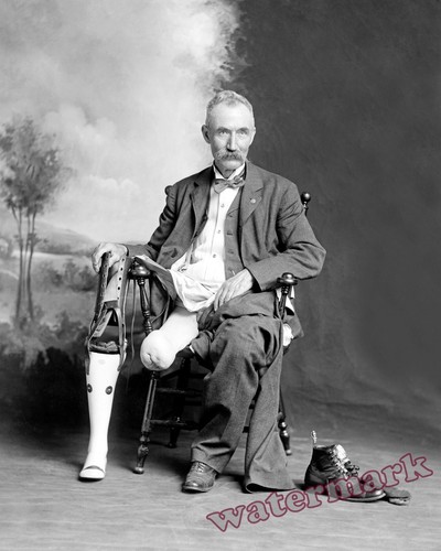 Civil War Amputee James Hanger & his Artificial Leg 1902 circa 8x10 ...
