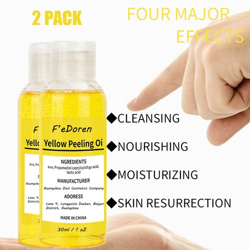 2PACK Unisex Yellow Peeling Oil Lighten Dark Spots Melanin Skin ...