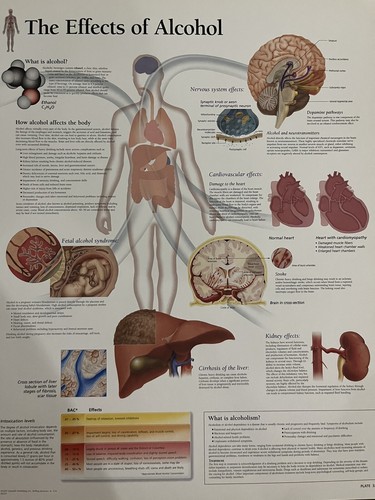 The Effects of Alcohol ~ Anatomy Poster ~ 11.25 x 14 Inches | eBay