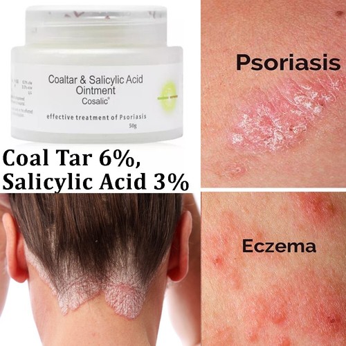 Coal Tar Cream 1.7oz - for Skin & Scalp Psoriasis - Coaltar 6% ...