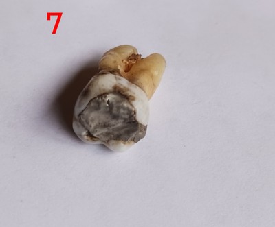 Human Teeth for sale | eBay