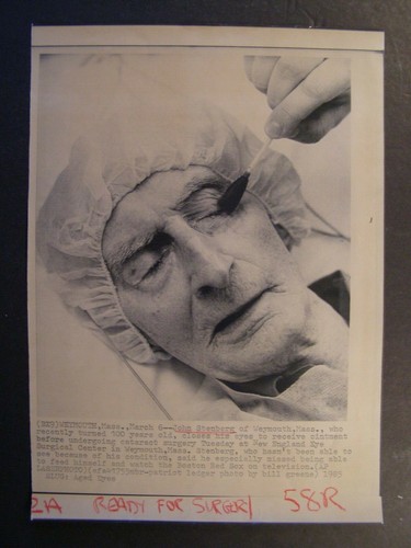AP Wire Press Photo 1985 John Stenberg 100 of Mass having Cataract ...