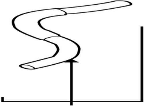 254122S201 Kia Hoseradiator lower 254122S201, New Genuine OEM Part | eBay