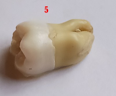 Human Teeth for sale | eBay